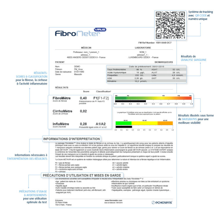 FibroMeter® ou Fibromètre®