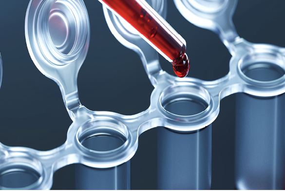 FibroTest® et FibroMax®